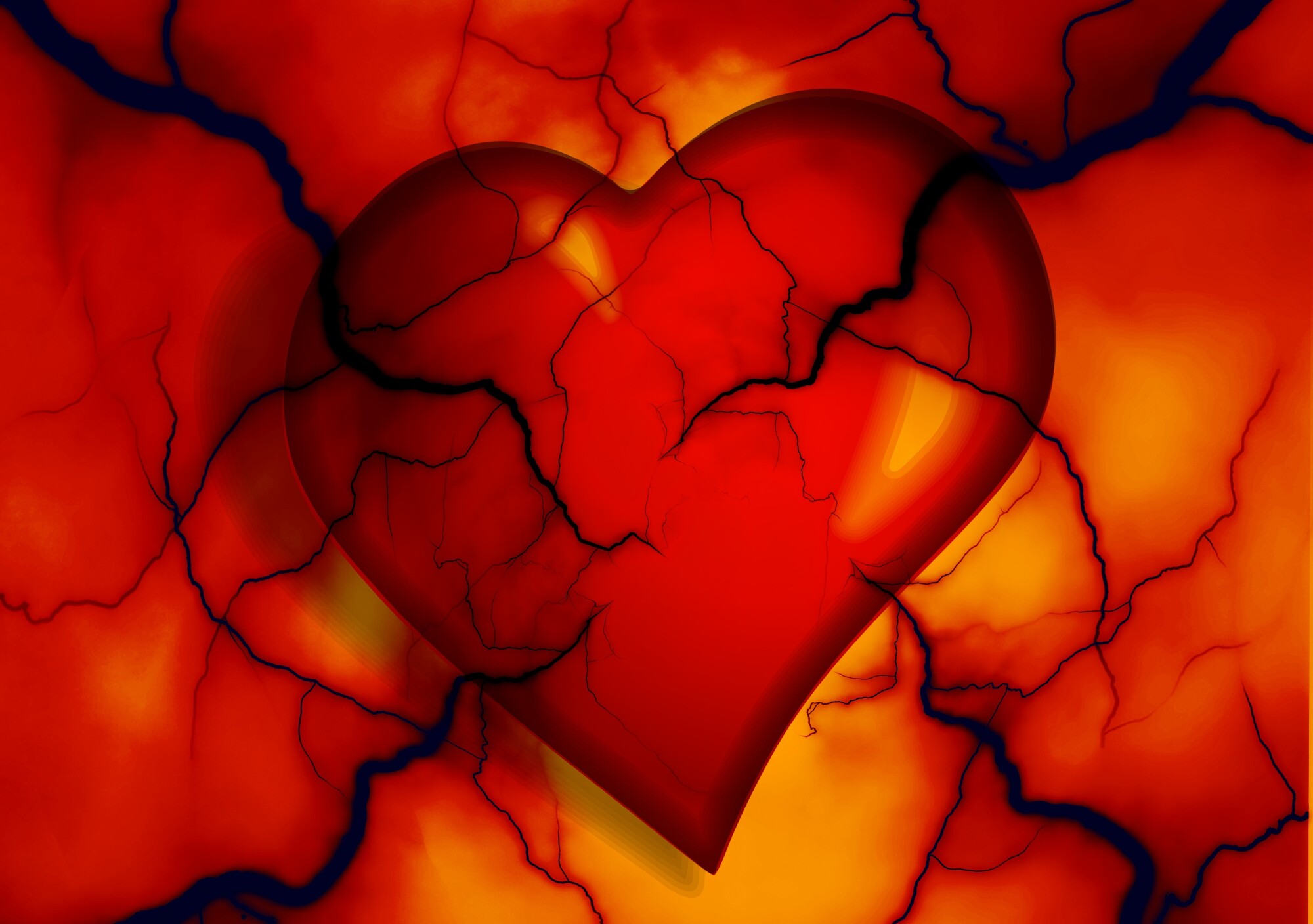 What Is Ranexa and How Can It Help Treat Angina? - PricePro Pharmacy